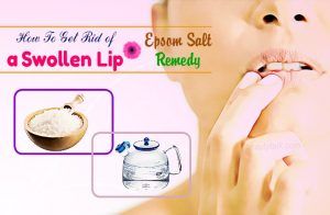 Top 15 Ways How To Get Rid Of A Swollen Lip Fast & Naturally