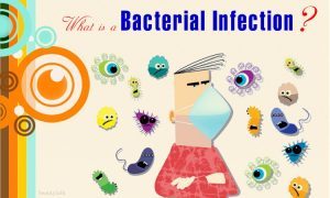 What Is A Bacterial Infection? Causes, Symptoms & Treatment